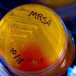 MRSA Screening in Surgical Patients - Evidence Based Reviews in Surgery ...